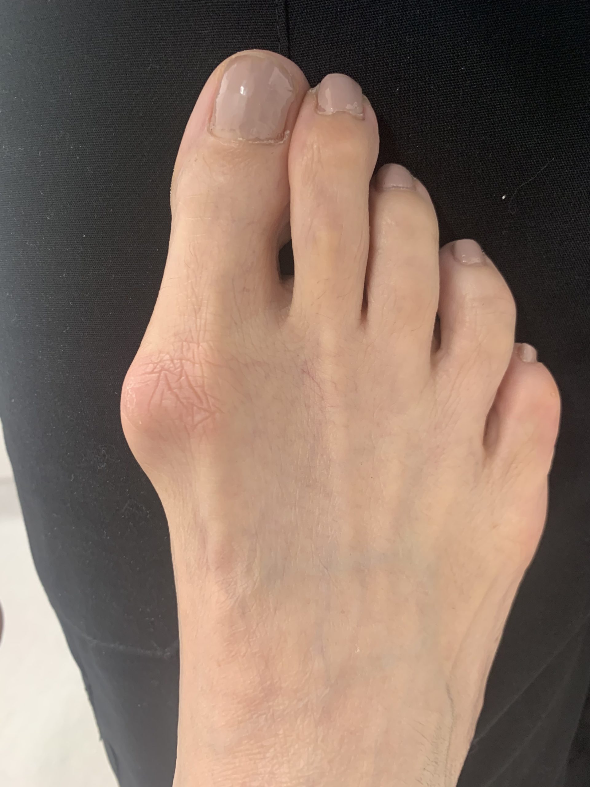 Northwest Surgery Center | Locations in WI & CO