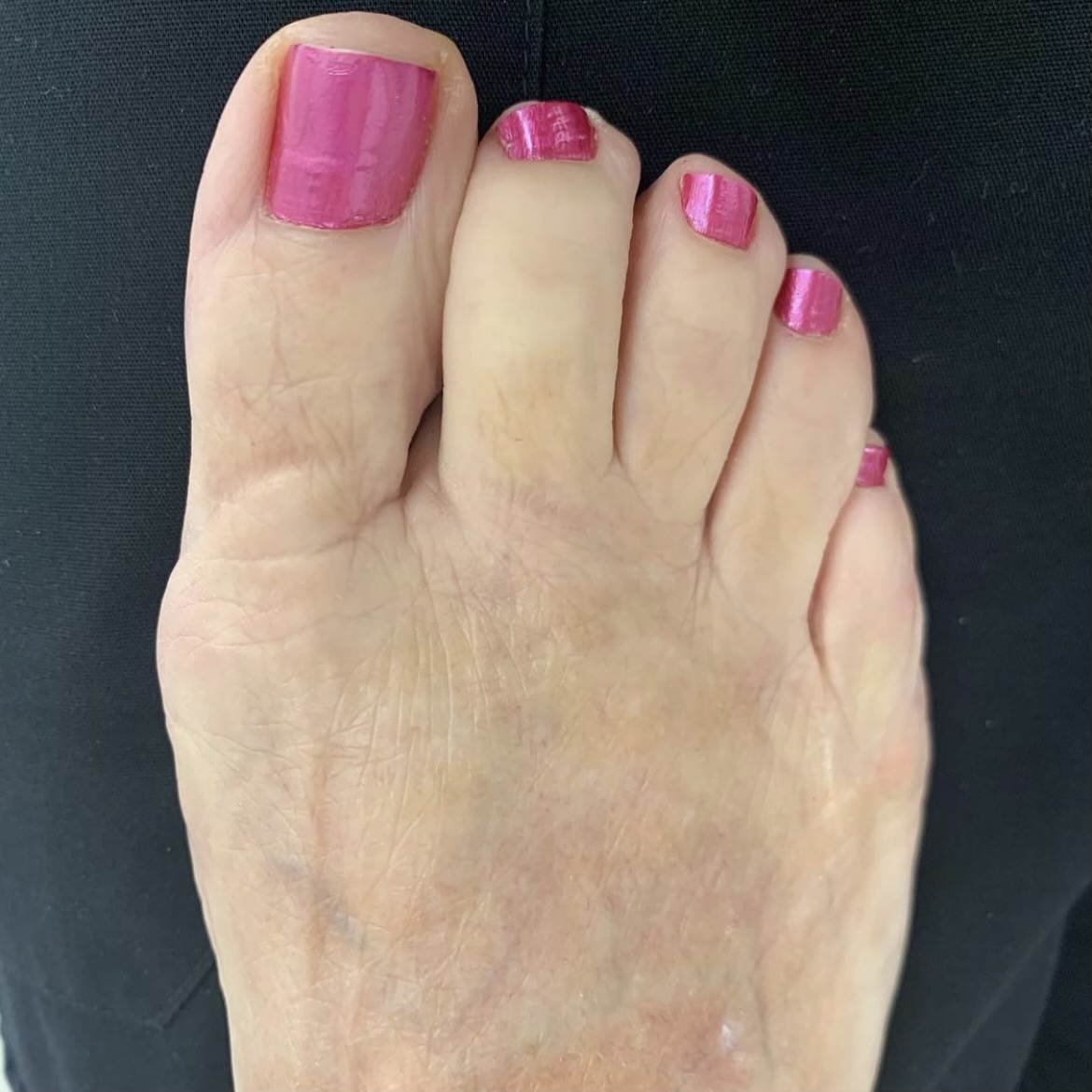 Northwest Surgery Center | Locations in WI & CO