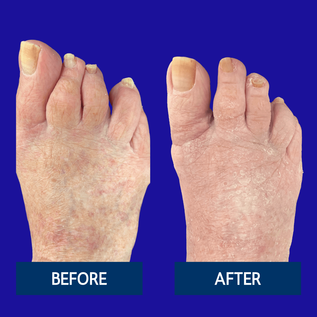 Podiatry Surgery | Northwest Surgery Center | Milwaukee, WI