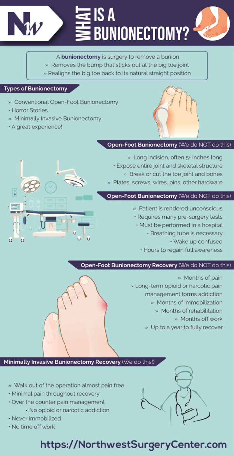 What is a Bunionectomy Infographic | Northwest Surgery Center
